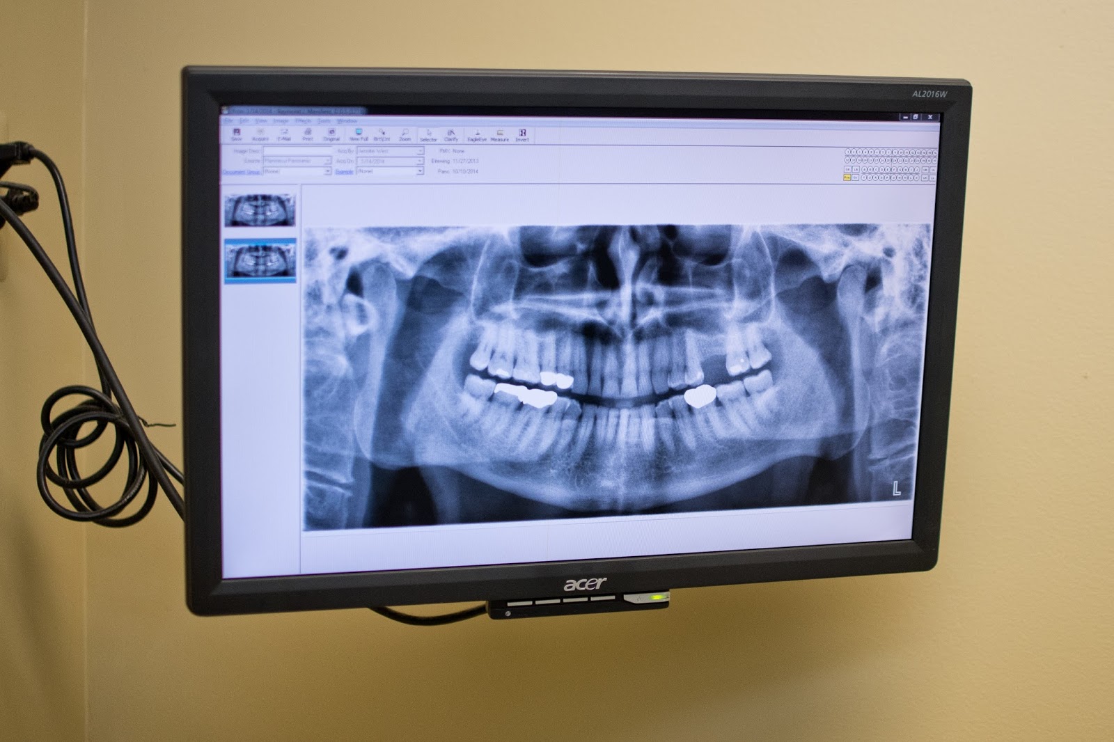 Germantown Dental Care Routine Dental Services Implants Root Canals germantown-dental-care-routine-dental-services-implants-root-canals