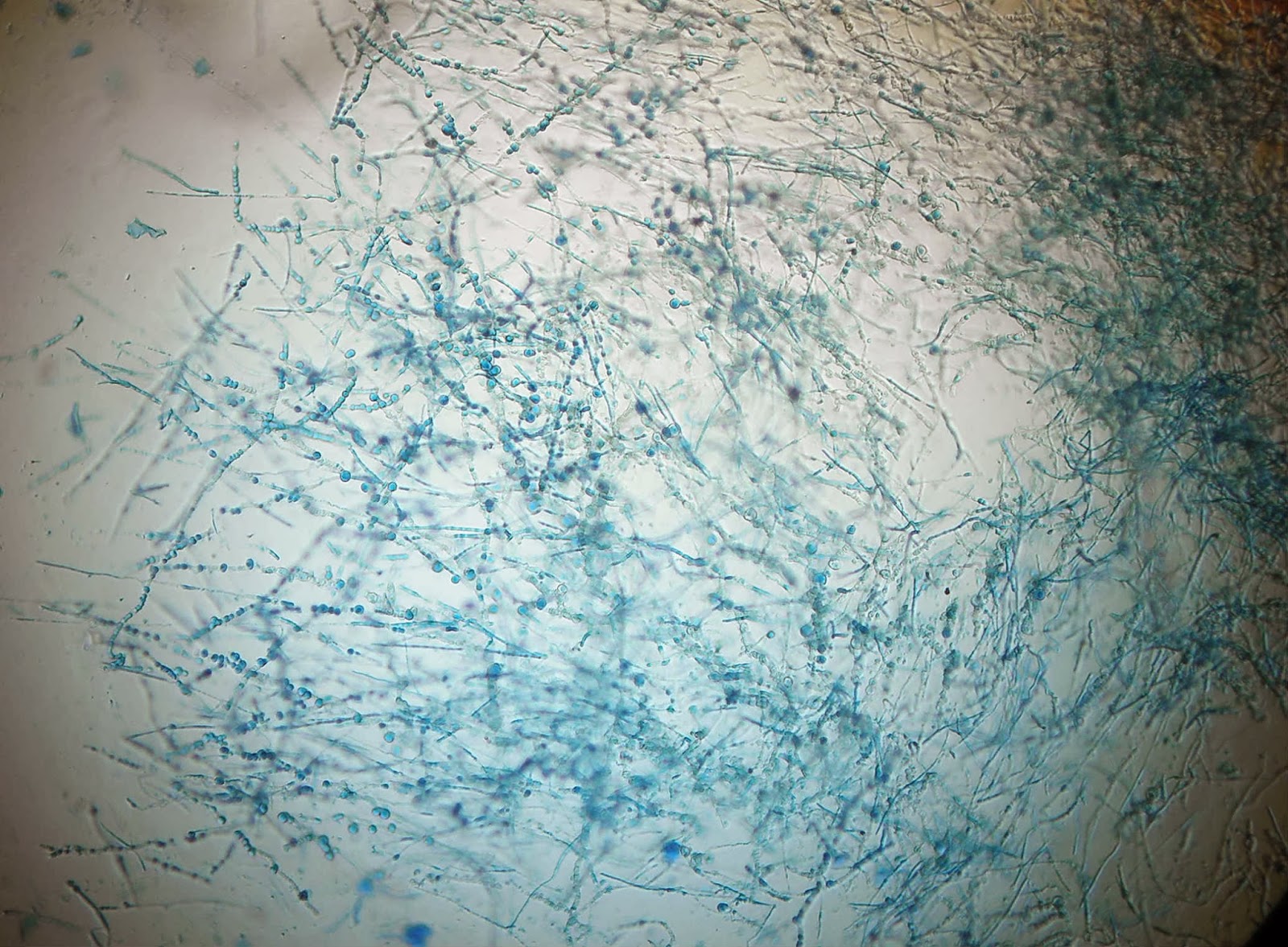 ATLAS MICOLOGIA: TRICHOPHYTON VERRUCOSUM