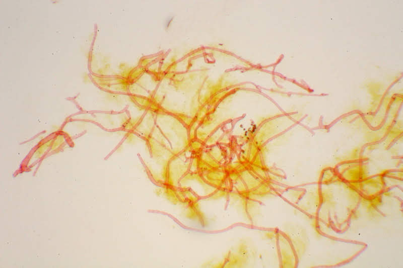 El mundo microscópico de los hongos: Pisolithus arhizus (Scop.per Pers ...