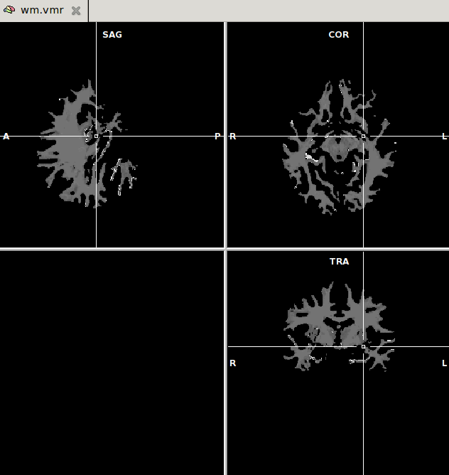 =Vision Group fMRI analysis guide=: Segmentation in Freesurfer, Rest in ...