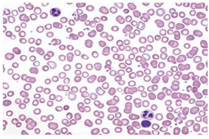 Células Sanguíneas: Microcitos