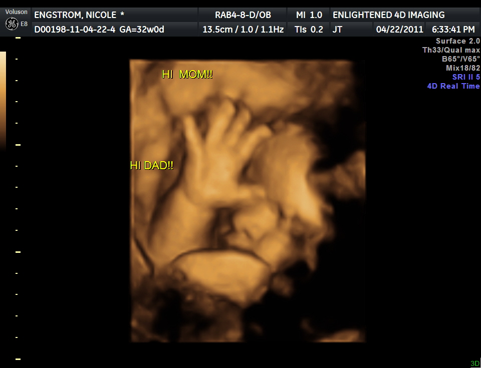 Through the years of Mackenzie.....: Ultrasound 4D 32 weeks:)