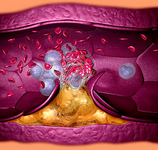 Lic. Psic. Gonzalo Cosenza : ¿Que es la homocisteína?