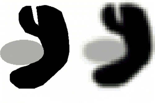 ABC Radiology Blog: Computed Tomography Artifacts