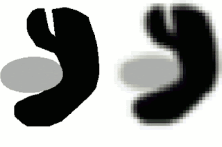 ABC Radiology Blog: Computed Tomography Artifacts
