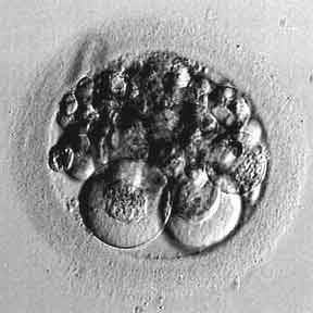 Embryo For Life: Aprendendo a Classificação dos Embriões