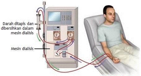 Sains 1 2 3: Kepentingan Menjaga dan Mengekalkan Kesihatan Ginjal