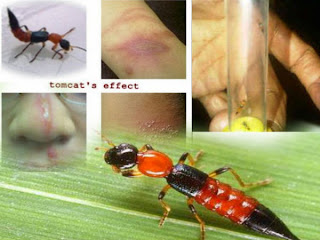 Gambar Bayi Teruk Di Gigit Semut Charlie/Tomcat - Berita Terkini