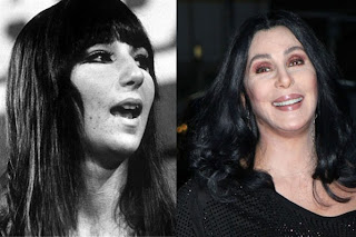 Cher Plastic Surgery