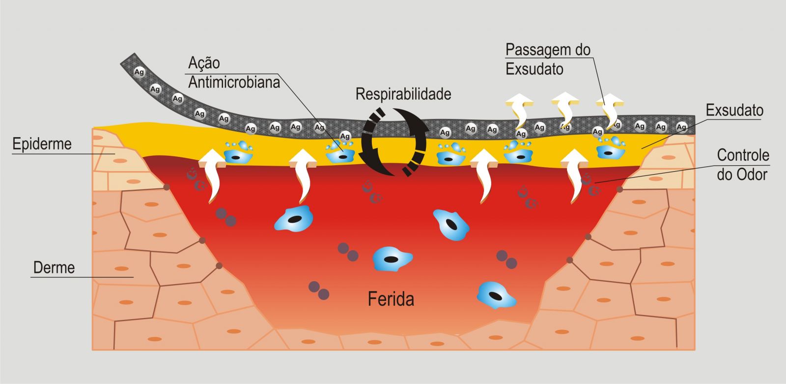Consultoria de Enfermagem Mendes & Hernandez: Sobre Feridas e Curativos