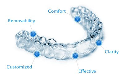 The Invisalign Product And How It Works