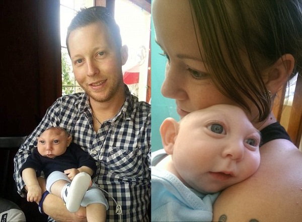 热头条: Illness call names anencephaly. According to the statistics of one ...