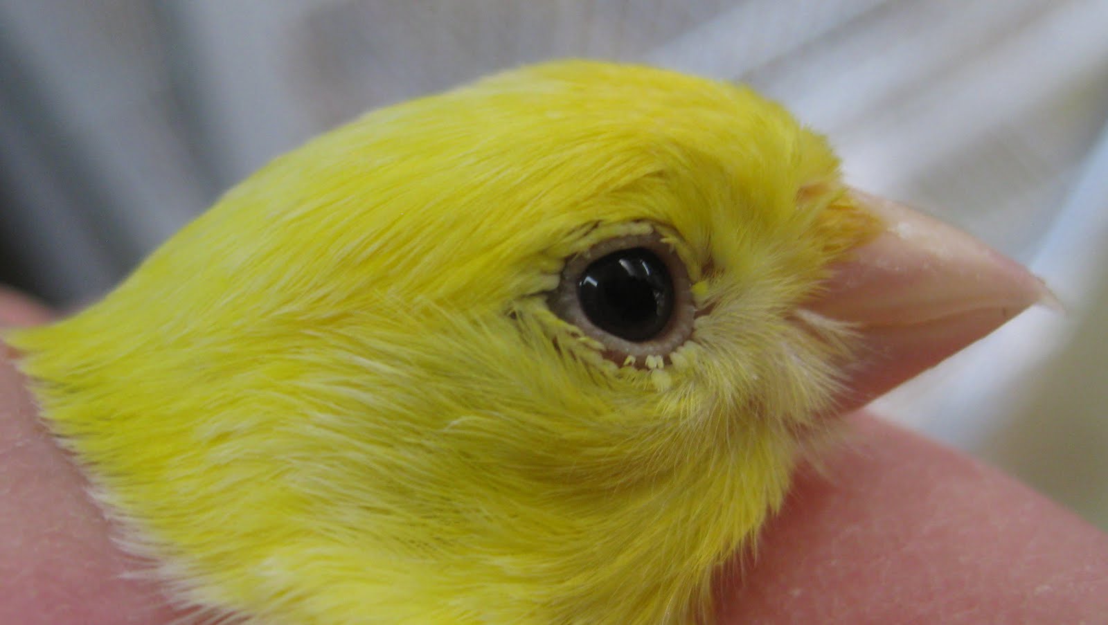 BIRD'S Eye Disorders