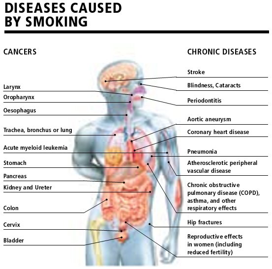 KESAN BURUK MEROKOK ~ Natural Health & Beauty. You Worth It.