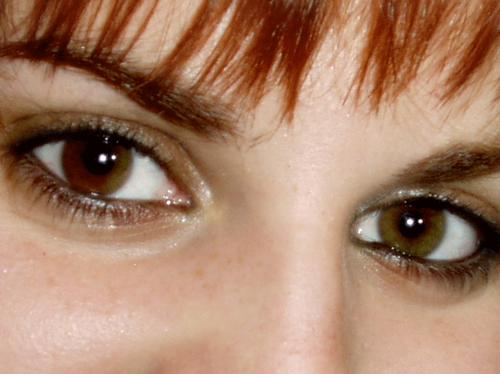 Heterocromia: ¿Que es heterocromia?