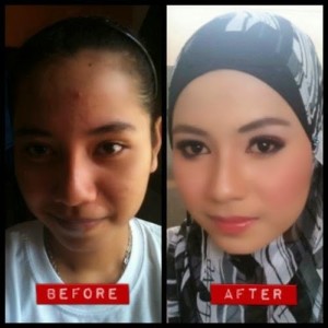 Testimoni Firmax3 Cream - Toko Firmax3 Indonesia