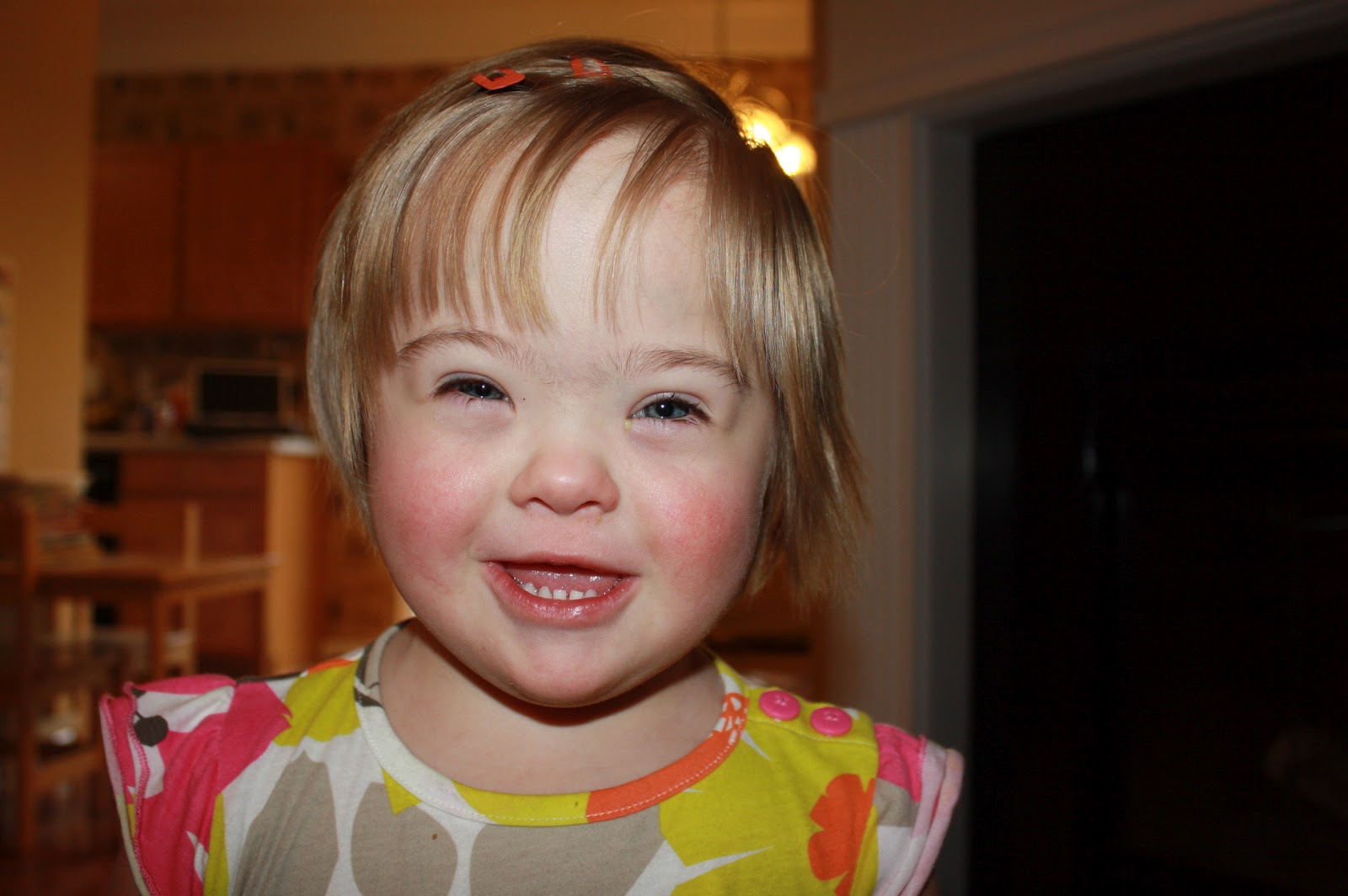 Mongoloid | define mongoloid at dictionary.com