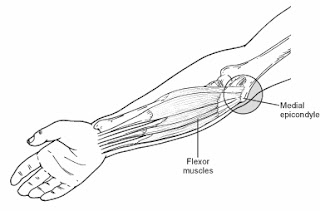 ARES Kinesiology Tape: Golf Elbow
