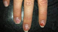 Pro Nail Tech Training: MMA: Methyl Methacrylate