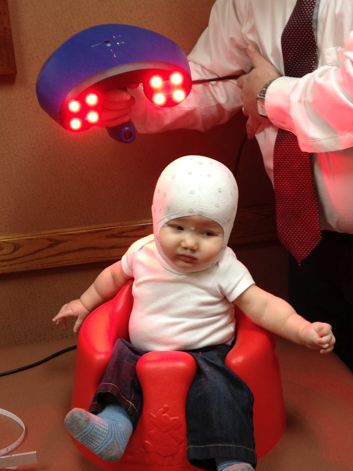 Duce Family: Brachycephaly