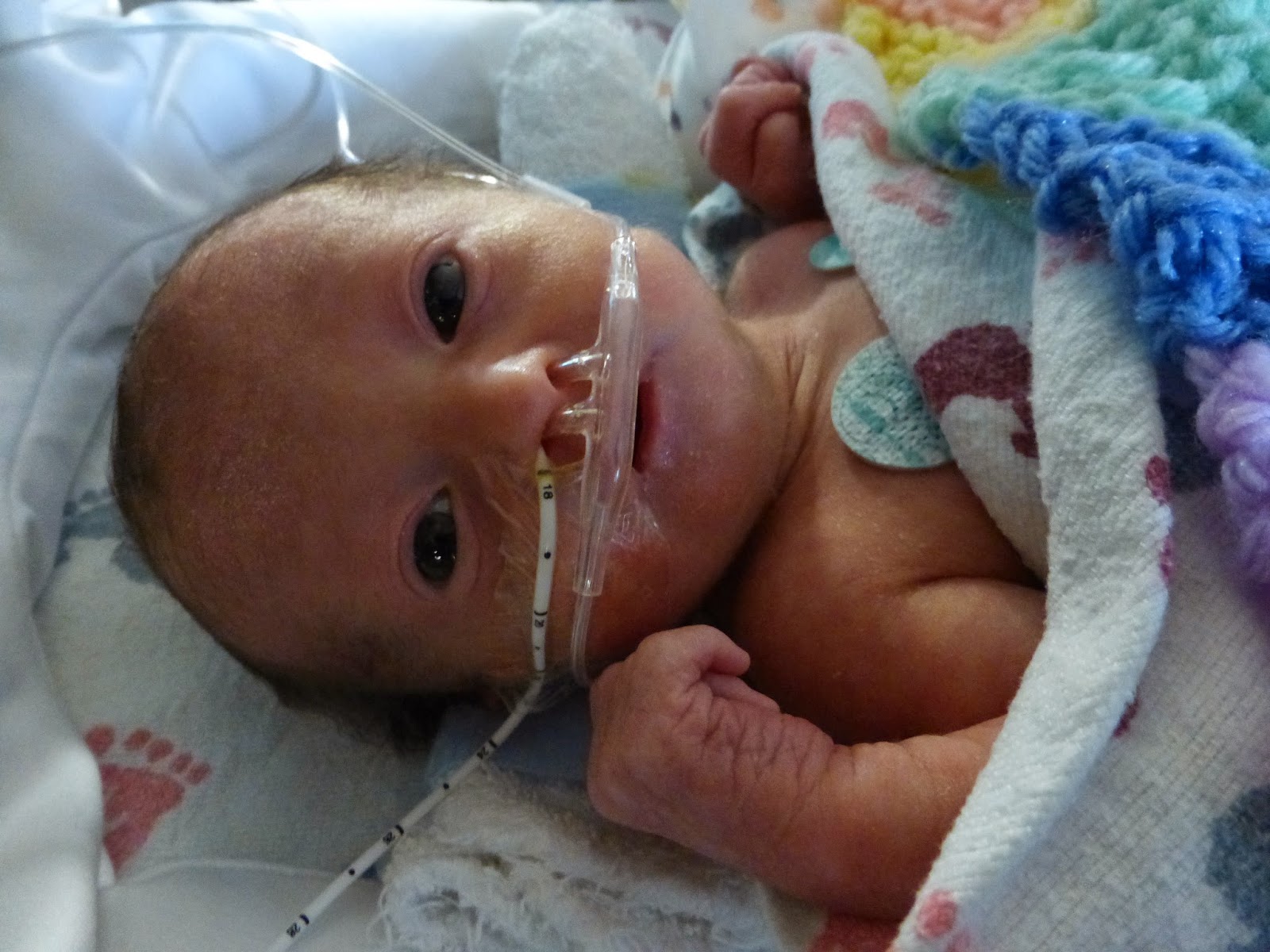 Cherishing Elise: Carrying and Loving Our Trisomy 18 Baby: Elise ...