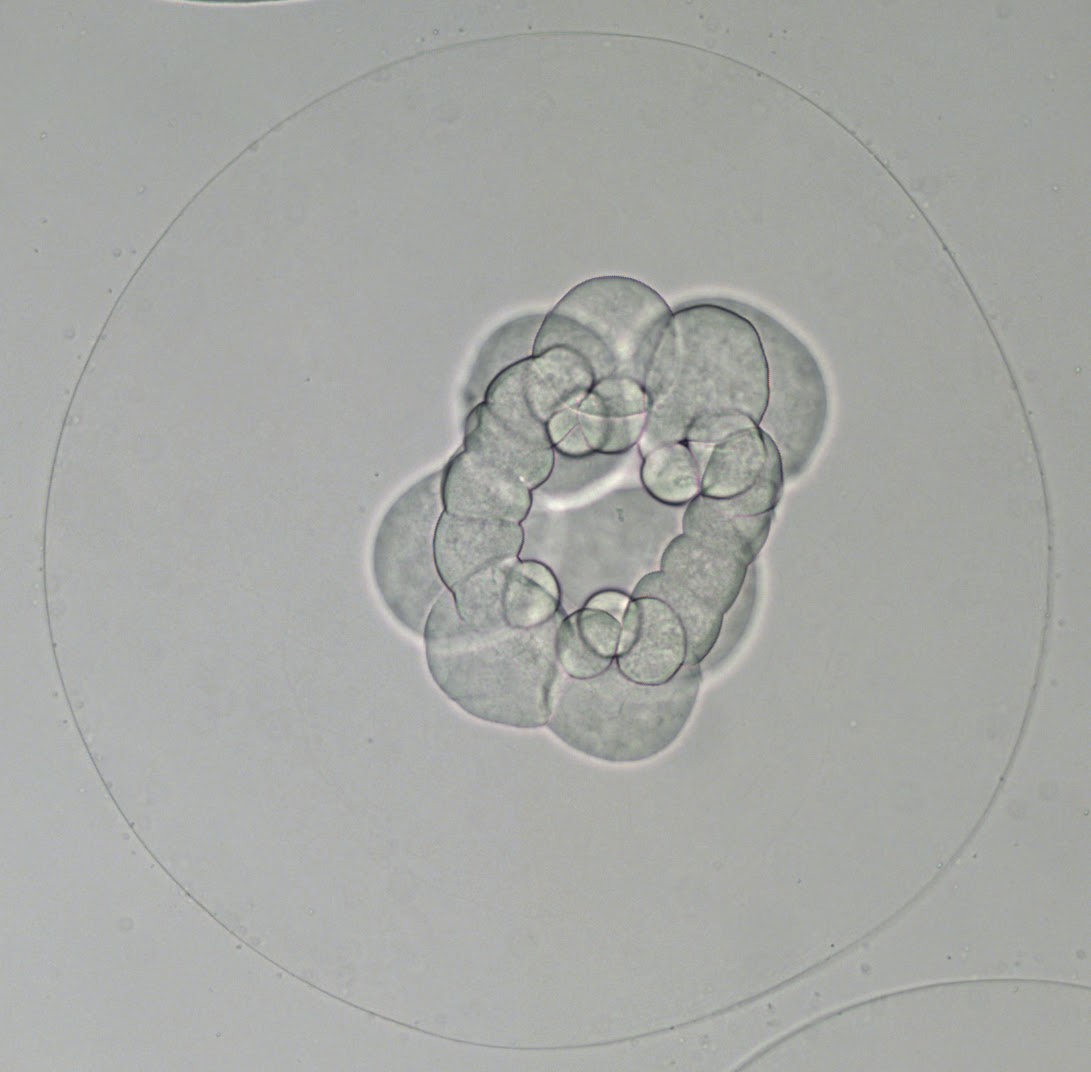 Invertebrate Embryology: Development of the ctenophore Beroe