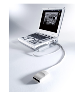 Ecografía: Ecógrafo