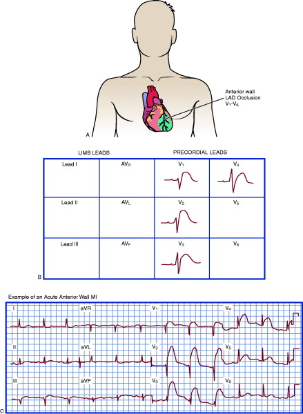 CCRN Review Questions & More