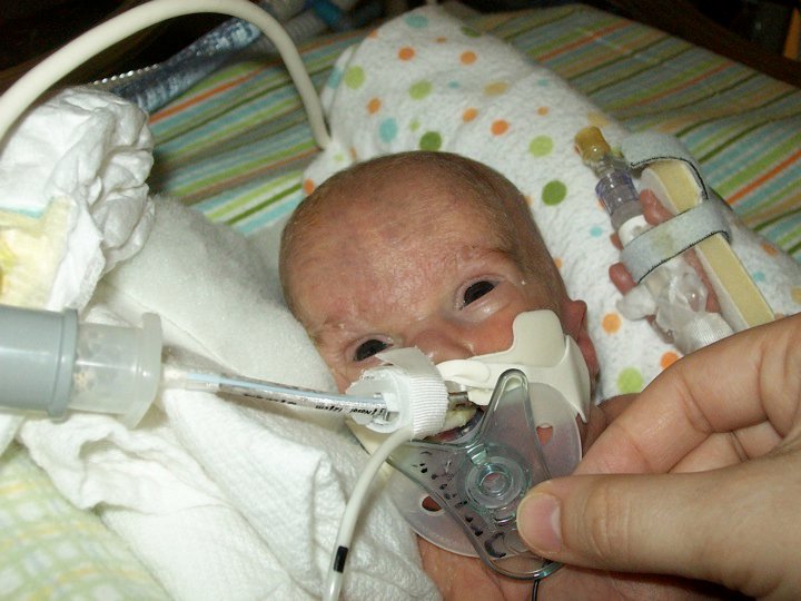 Frog In Stitches: "Birth" Story