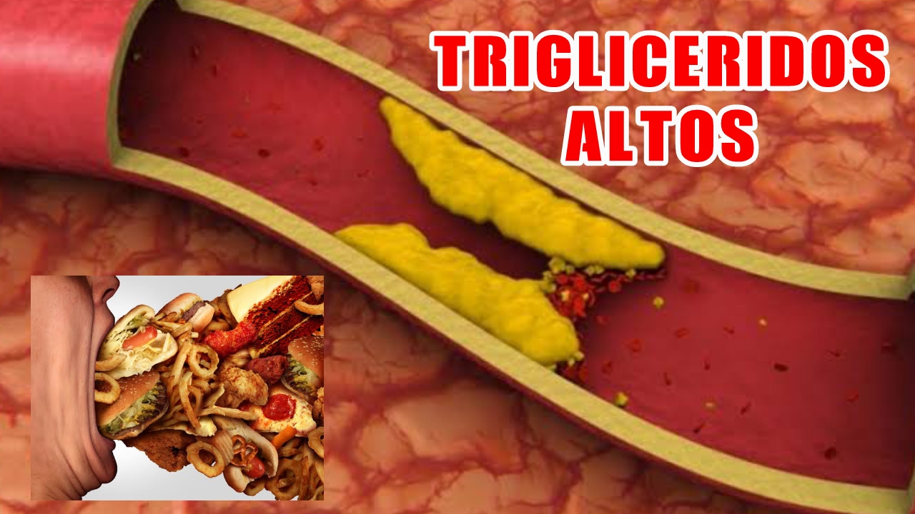 Que son los TRIGLICERIDOS y síntomas de los TRIGLICERIDOS ALTOS