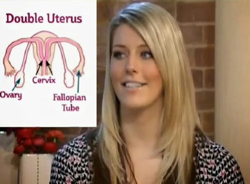 The Woman With Two Vaginas Gossip Lanka Hot News Sri Lanka Latest Breaking News