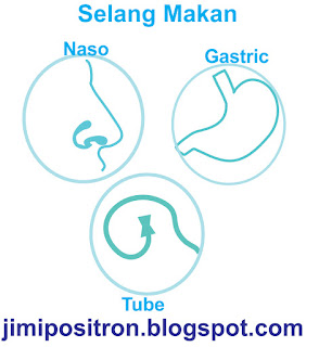 NGT (Naso gastric Tube) Selang Makan