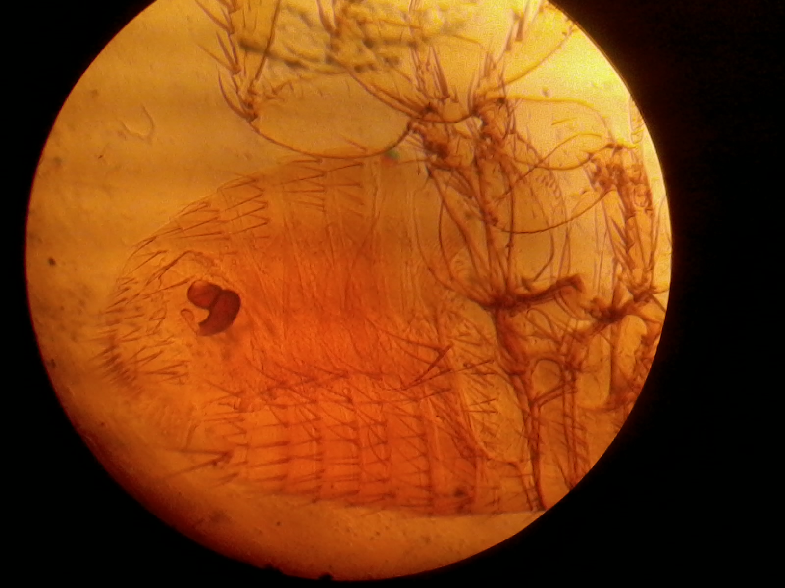 KLIMAKS: KUTU & PINJAL