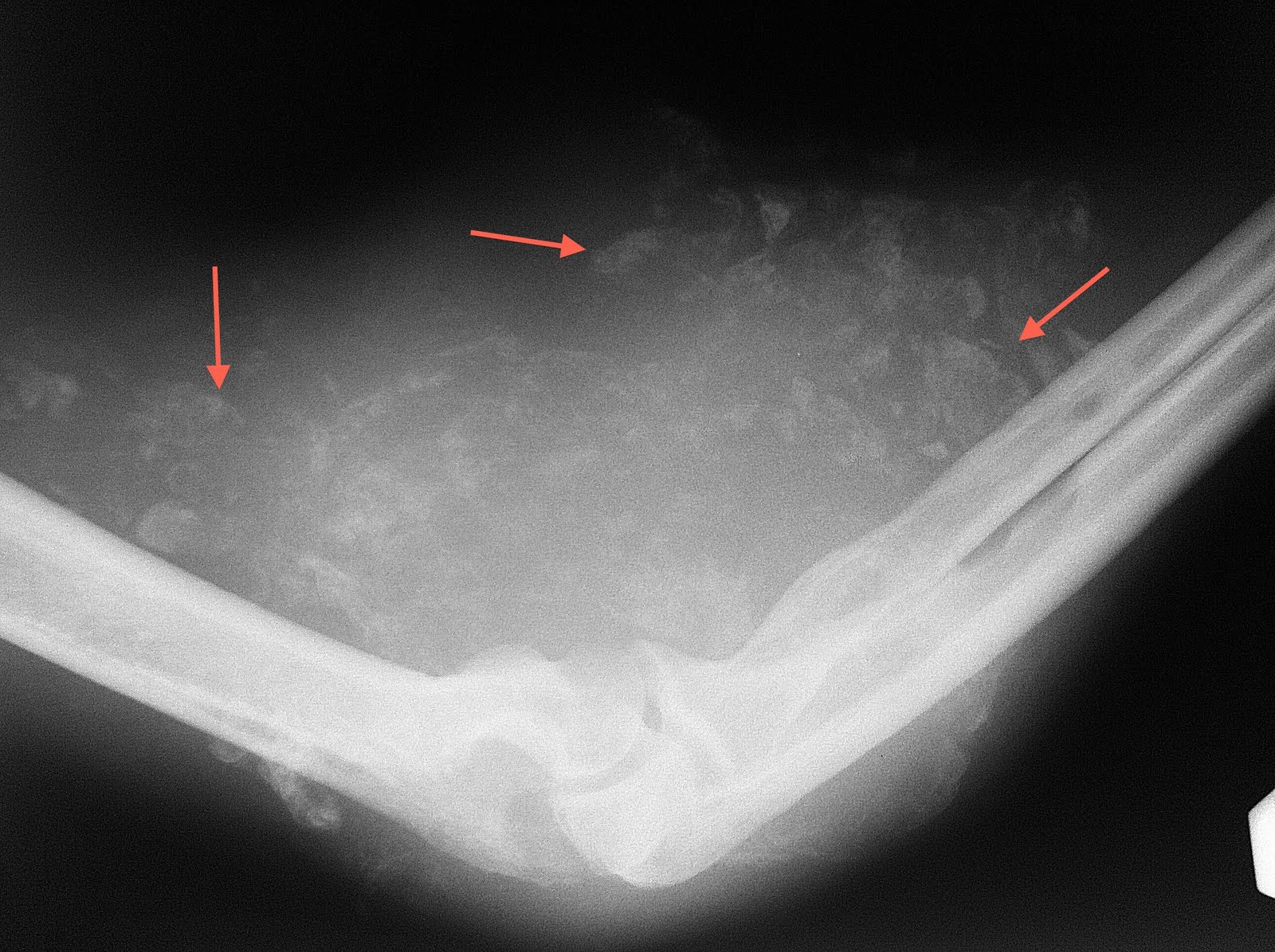 MedView Medical Imaging Consultancy Info Page: Soft tissue tumor