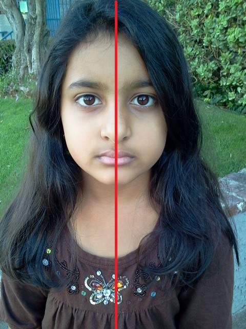 A Biological Collection: Bilateral Symmetry