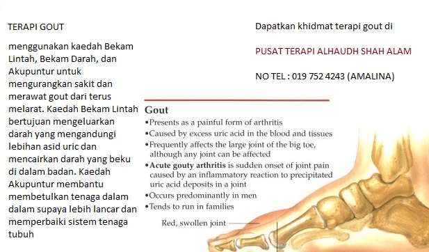 Terapi Bekam , Akupuntur, Urutan Saraf , Yumeiho dan Lintah Wanita dan ...