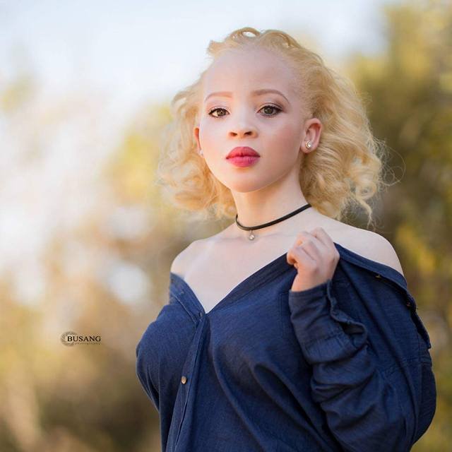 Meet Mokoena-South African albino Model . - ZongoPlus