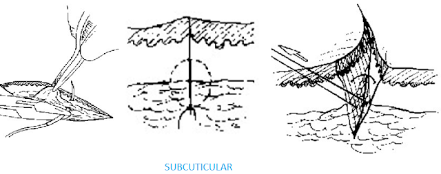 human body muscles: SUTURE MATERIALS AND SUTURING TECHNIQUE