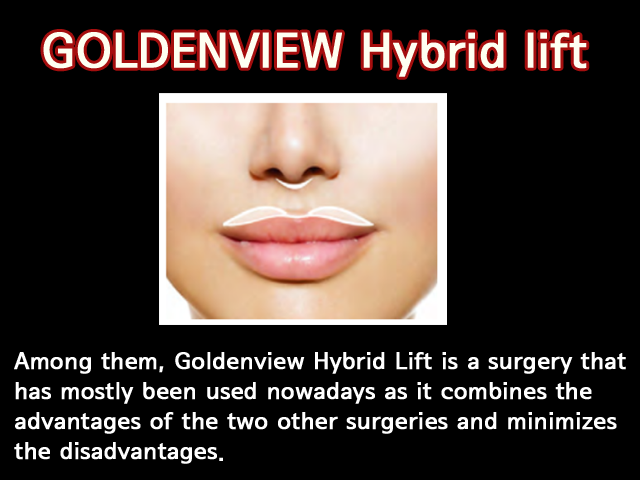 Goldenview Plastic surgery: Lip lift - philtrum surgery (philtrum ...