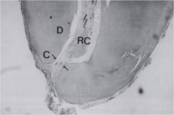 Preclínico de endodoncia