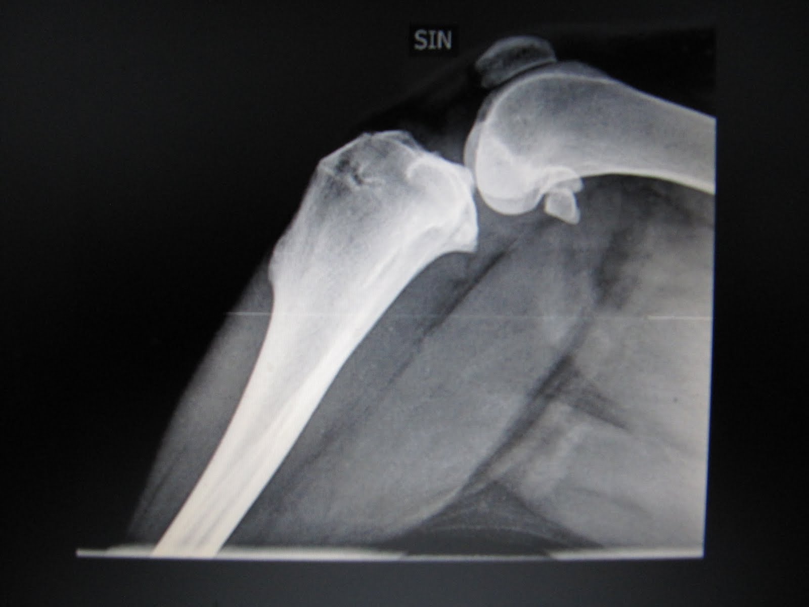 Kirsula: marraskuuta 2012