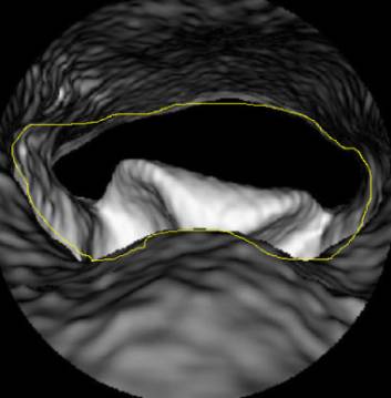 Facial Development Newsletter: THE SCIENCE BEHIND THE HOMEOBLOCK™ APPLIANCE
