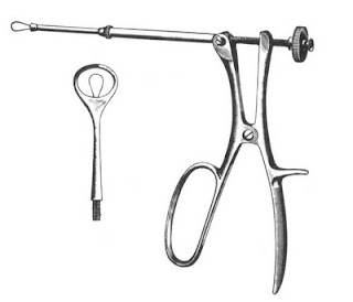 wholesalesurgicalinstruments: Tonsillectomy and Adenoidectomy ...