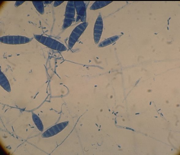 Microbiología y Epidemiología: Microsporum