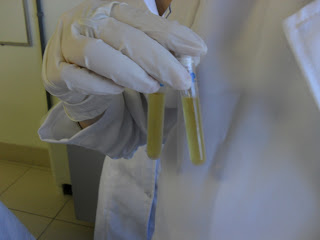 Citologia Clínica - 2011: LCR - Câmaras