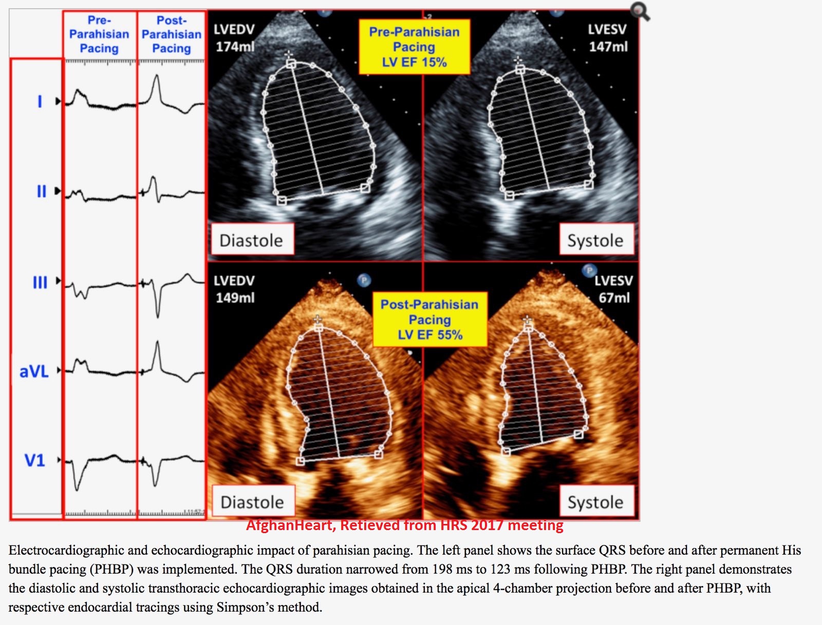 Dr.Nabil Paktin's Journal of Cardiovascular Medicine Blog ژورنال ( قلب ...