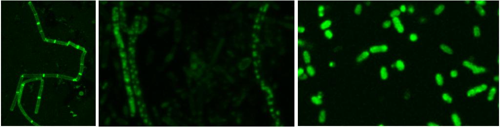 Microbial Typing with Antibiotics and Antibodies: Microbial Typing with ...