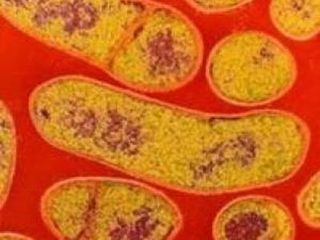 Online Pharmacy: INFECTIOUS DISEASES