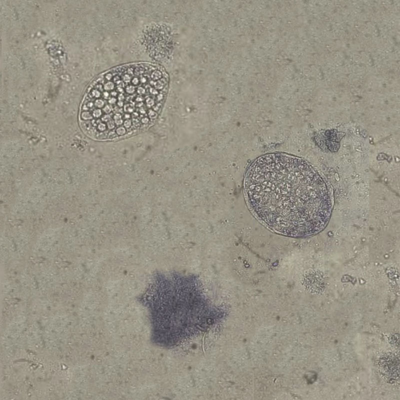 List 95+ Pictures Pictures Of Parasites In Stool Superb