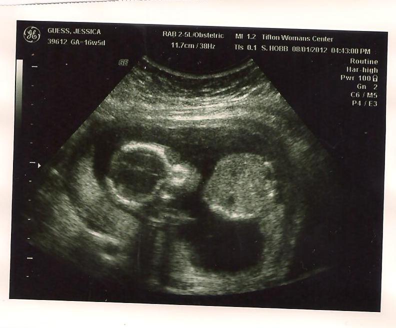 Can you "Guess"?: Baby Kelly Update: The Big Reveal!